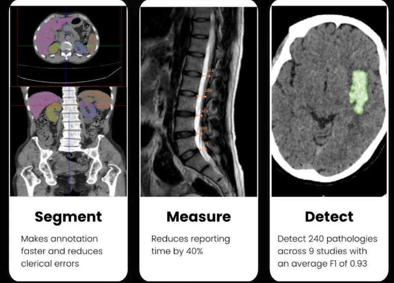 5C Network: Redefining Radiology with AI for Bharat and Beyond | YourStory