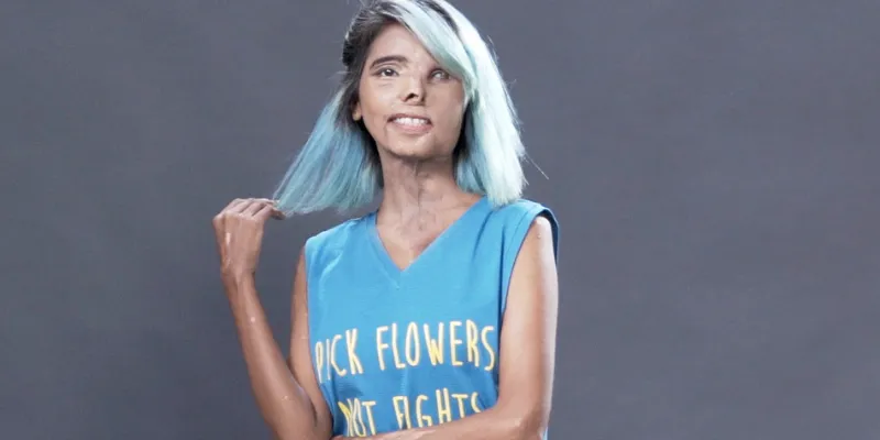Burnt as a baby, this acid attack survivor is now a fashion model ...